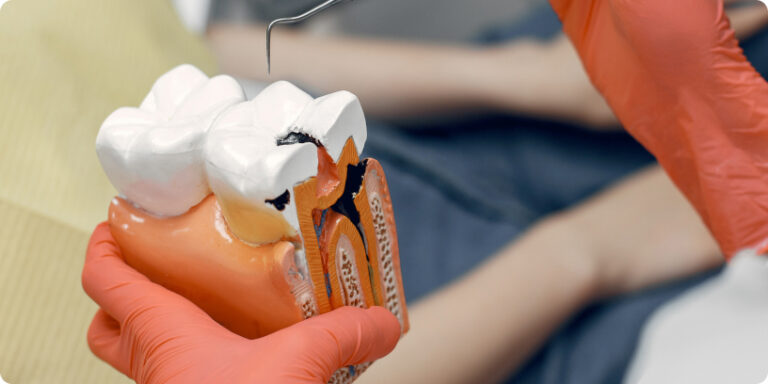 Cabinet dentaire A Murza à Furiani | Traitement endodontique